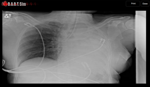 DART ECG Simulator “Classic” for Windows PC/MAC Computer (Download) 1 ...