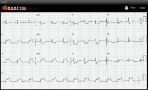 DART Sim Complete ACLS Instructor Start-up Kit – ECG Simulator by DART Sim